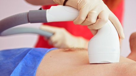 Les étapes d'une séance d'épilation laser des jambes - Minutefacile.com